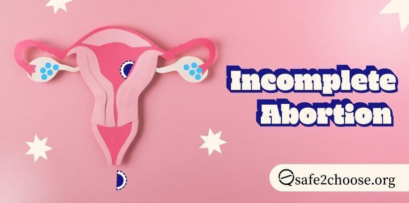 Incomplete Abortion: Signs and What Should You Do